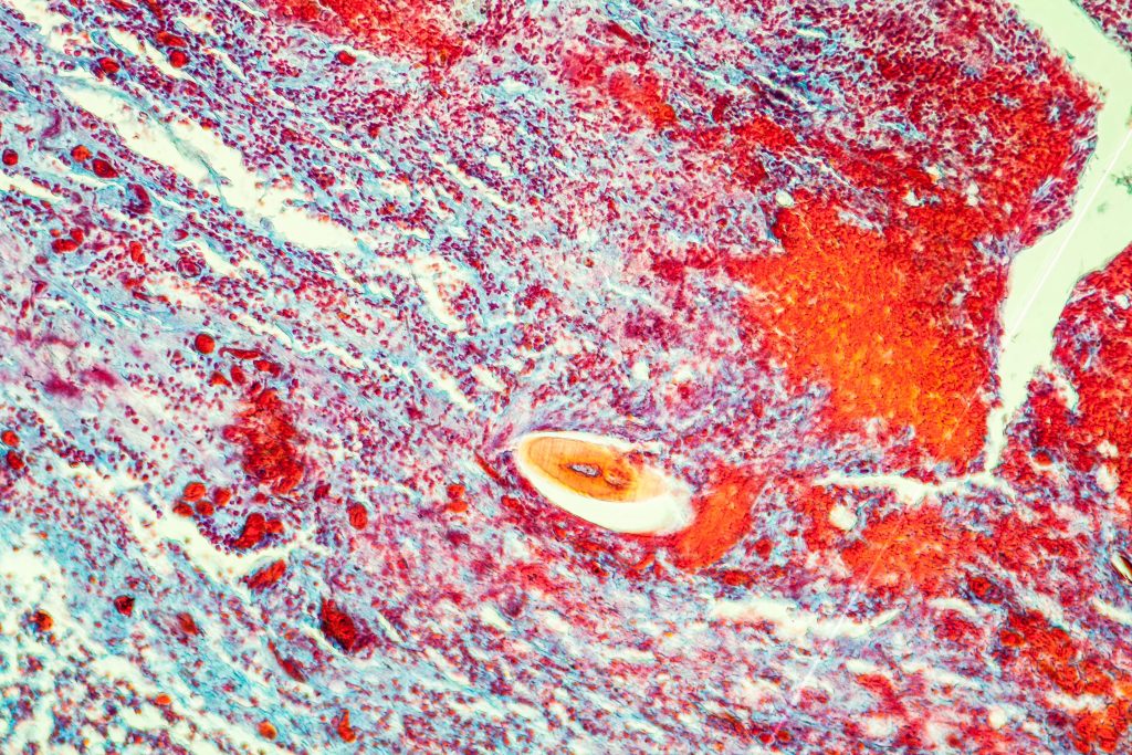 Milben: ungebetene und meist wenig beliebte Spinnentiere